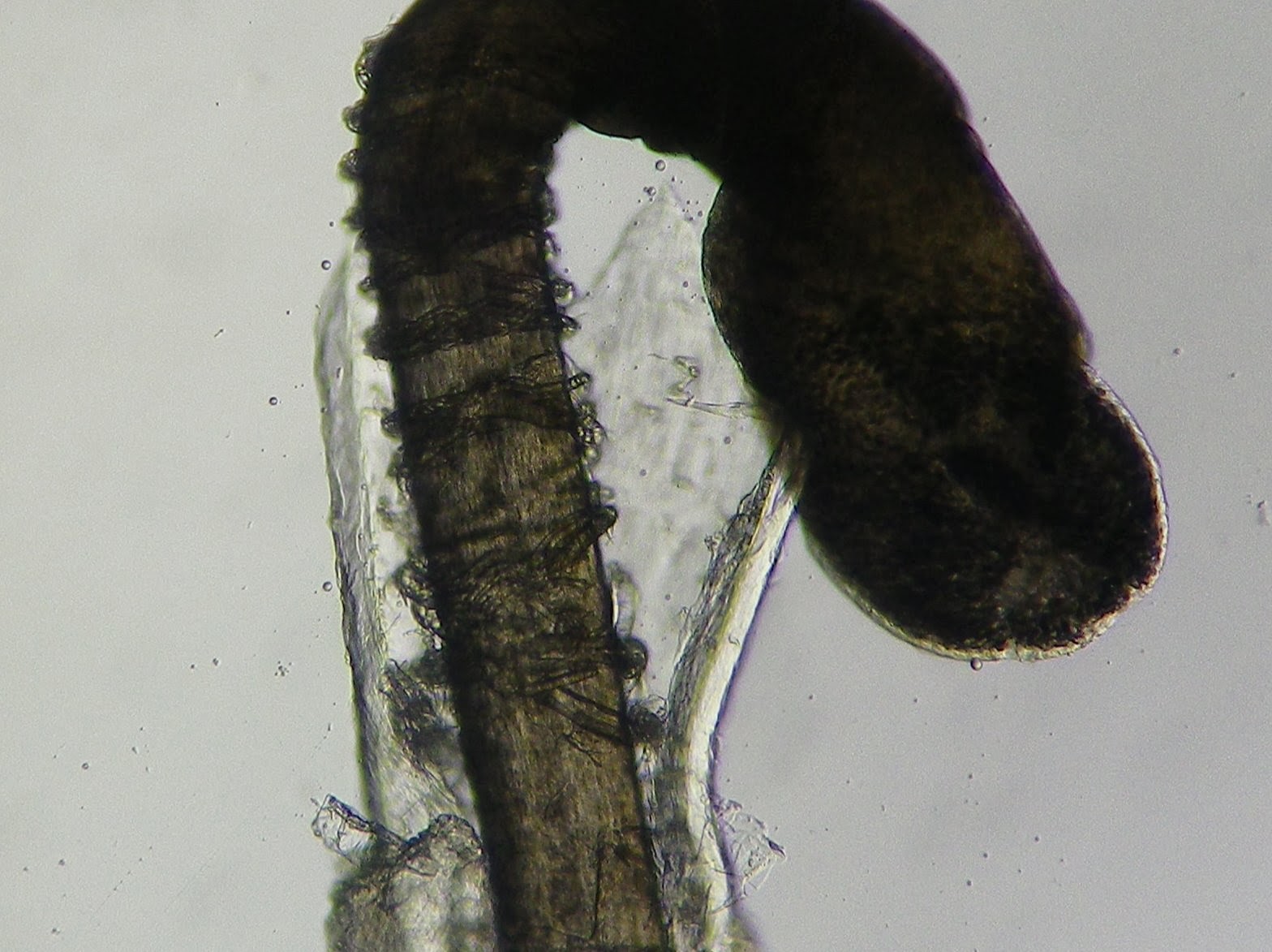 Under The Microscope Hair Follicle Nerve Endings under-the-microscope-hair-follicle-nerve-endings