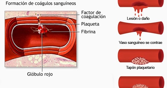 LA HEMOFILIA: COAGULACIÓN DE LA SANGRE