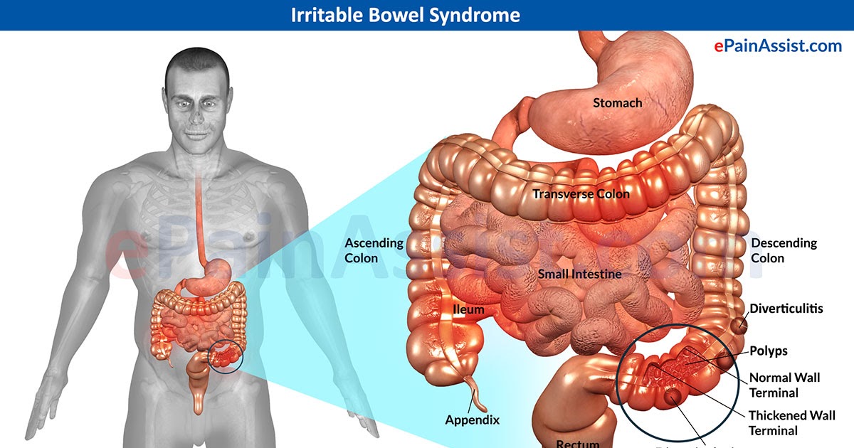 Dermocosmiatria 8 Puntos Eficaz De Acupresi n Para S ndrome Del dermocosmiatria-8-puntos-eficaz-de-acupresi-n-para-s-ndrome-del