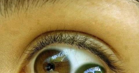 Pupula Duplex (Eyes With 2 Pupils) What is Pupula Duplex - Best Voice