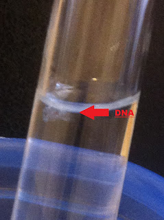 New and Exciting: You Can Extract Your DNA From Cheek Cells!