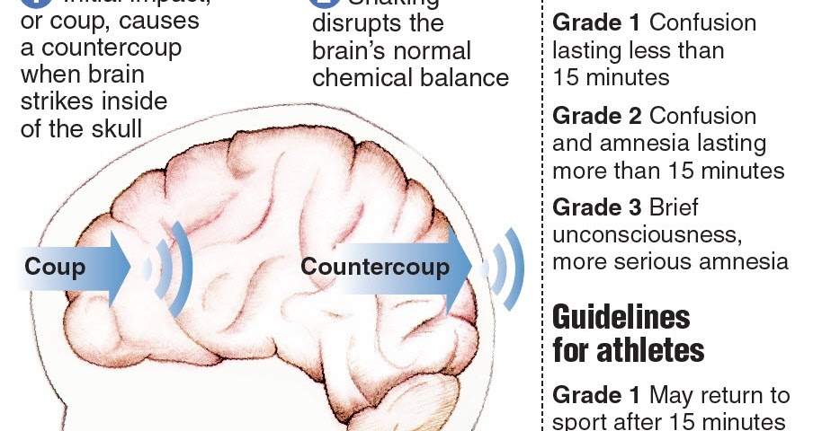 When Head Injury or Trauma In Sports Leads To Memory Loss and Chronic ...