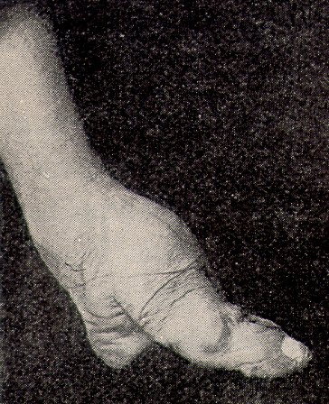 iGordo.net: Chinese foot binding