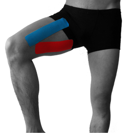 ARES Kinesiology Tape: Groin Pull / Strain
