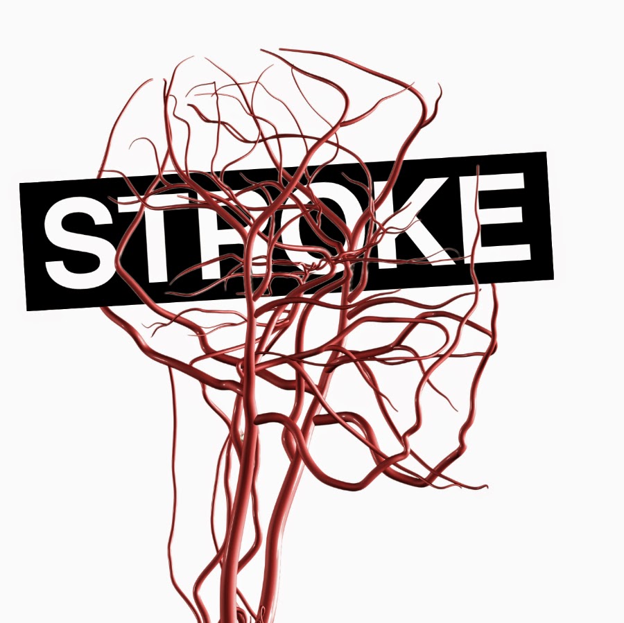 STROKE-The second leading cause of death in the world ~ PublicWellness Group
