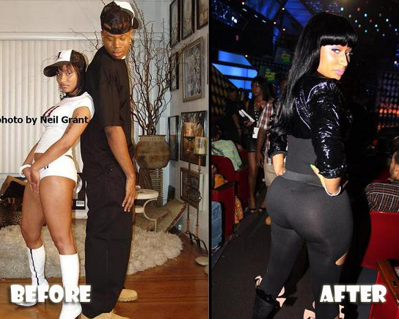 CELEBRITIES: Nicki Minaj Plastic Surgery Before & After Pictures 2012 CELEBRITIES: Nicki Minaj Plastic Surgery Before & After Pictures 2012