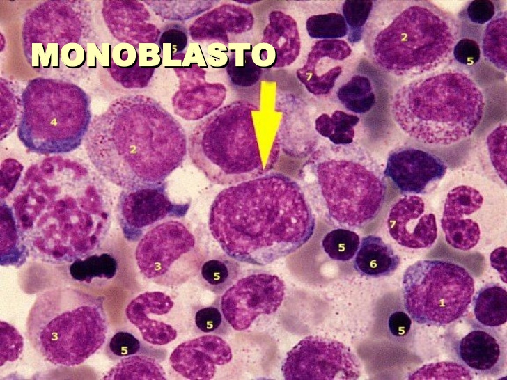 Células Sanguíneas: Maduración Monocítica
