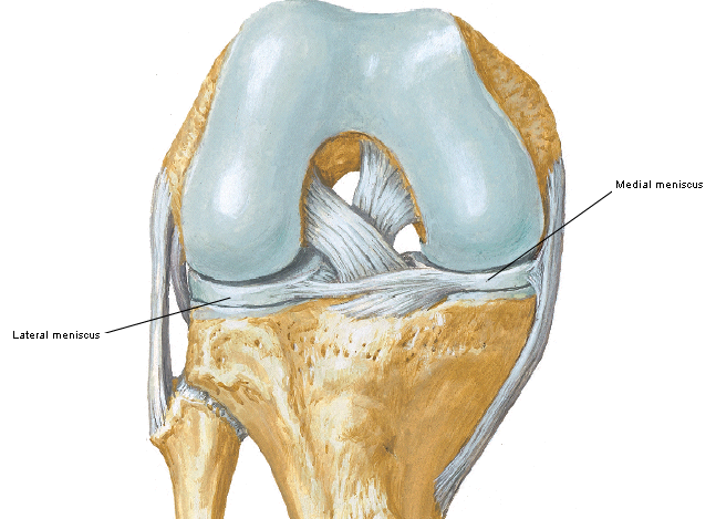 MedView Medical Imaging Consultancy Info Page Soft Tissue Calcification medview-medical-imaging-consultancy-info-page-soft-tissue-calcification