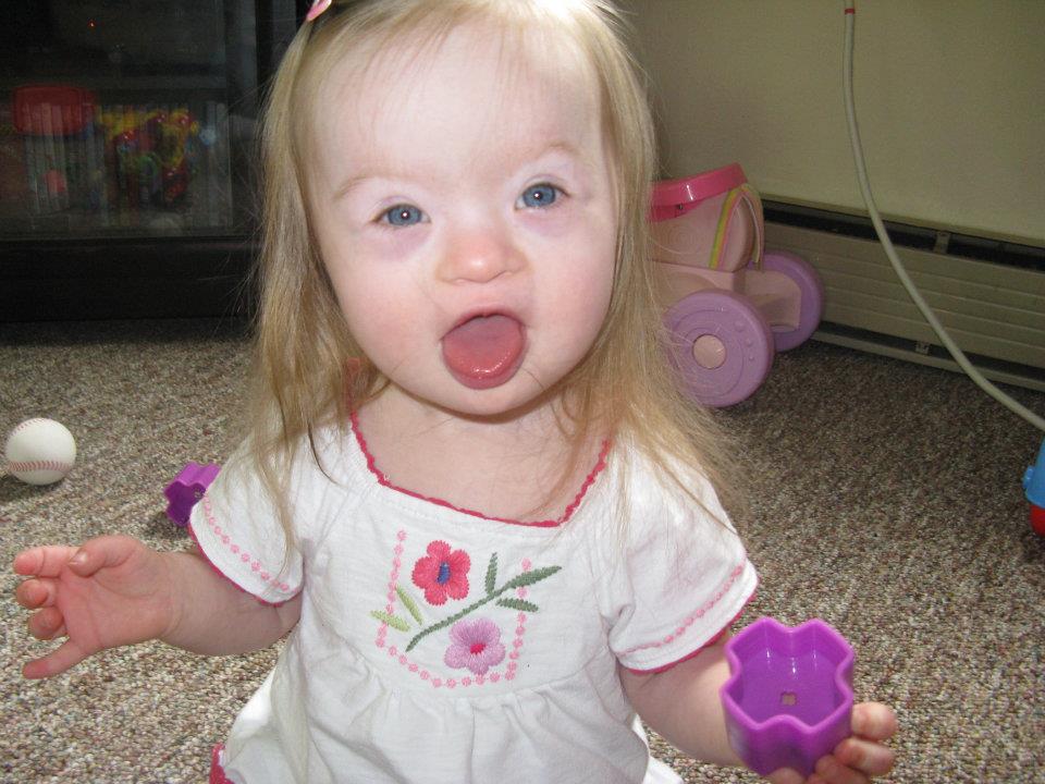 Sindrome De Triplo X EDULEARN sindrome-de-triplo-x-edulearn