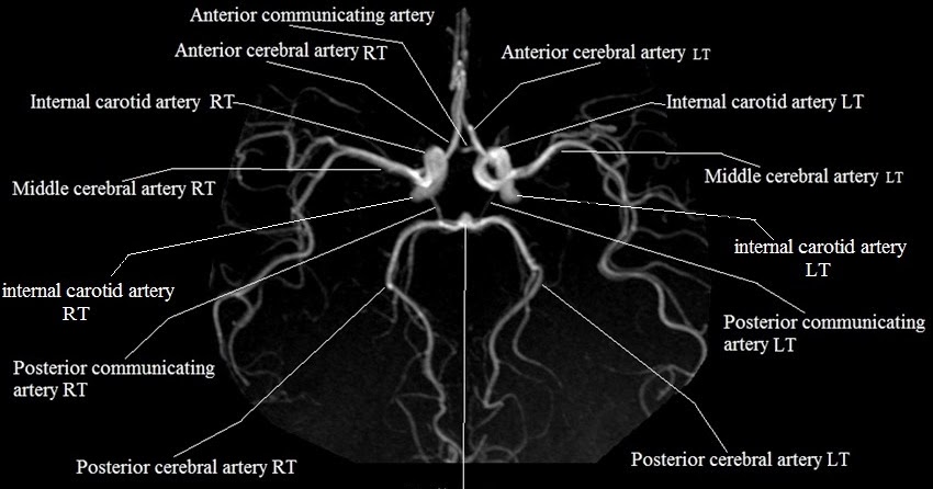 Radiology Anatomy Images : MRA Brain anatomy Radiology Anatomy Images : MRA Brain anatomy