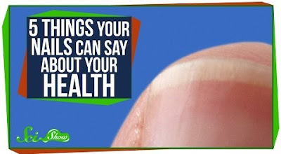 5 Things Your Nails Can Say About Your Health - Strength Womens