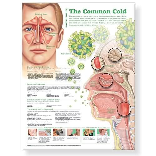 Information of diseases: Causes of Common Cold Information of diseases: Causes of Common Cold