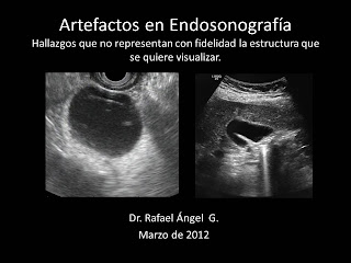 Endosonografía INCHIJAP: Artefactos en Endosonografía