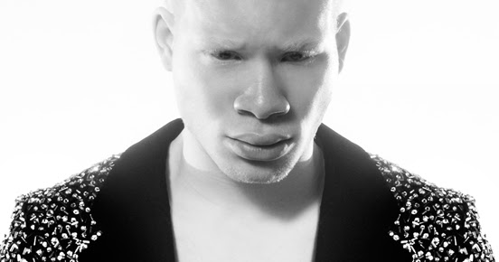 Albino Model Sir Maejor: Albino Model & Actor Sir Maejor (Full Wiki Bio)