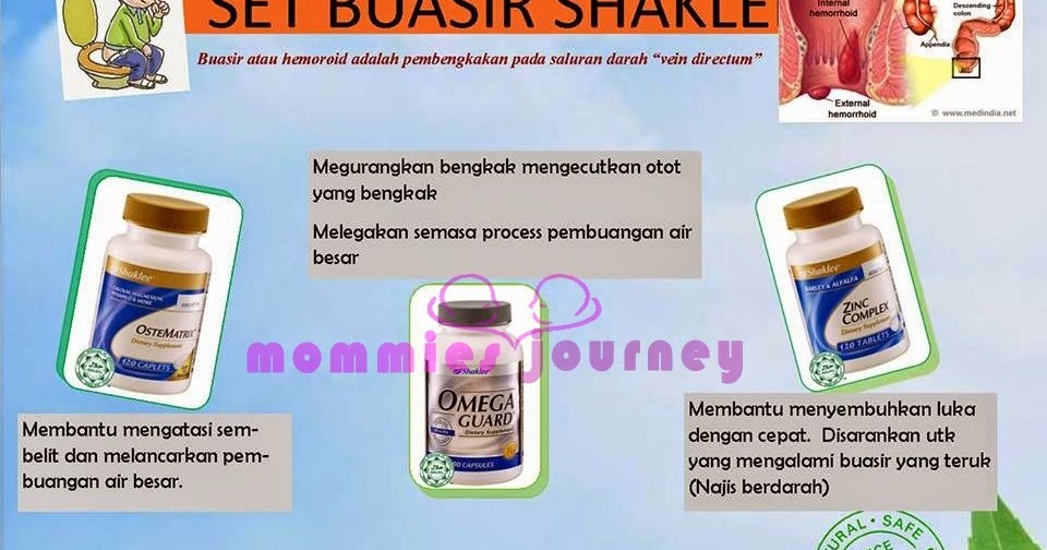Cara Mencegah Buasir dan Jenis-Jenis Buasir Cara Mencegah Buasir dan Jenis-Jenis Buasir