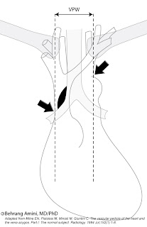 Roentgen Ray Reader: The Vascular Pedicle