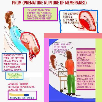 Dear Nurses: WHAT IS PROM ( PREMATURE RUPTURE OF MEMBRANES)