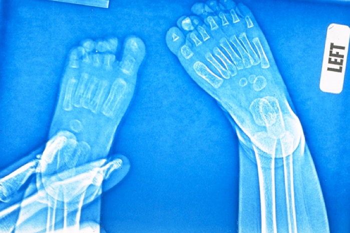 Too Many Toes Foot Care In Michigan too-many-toes-foot-care-in-michigan