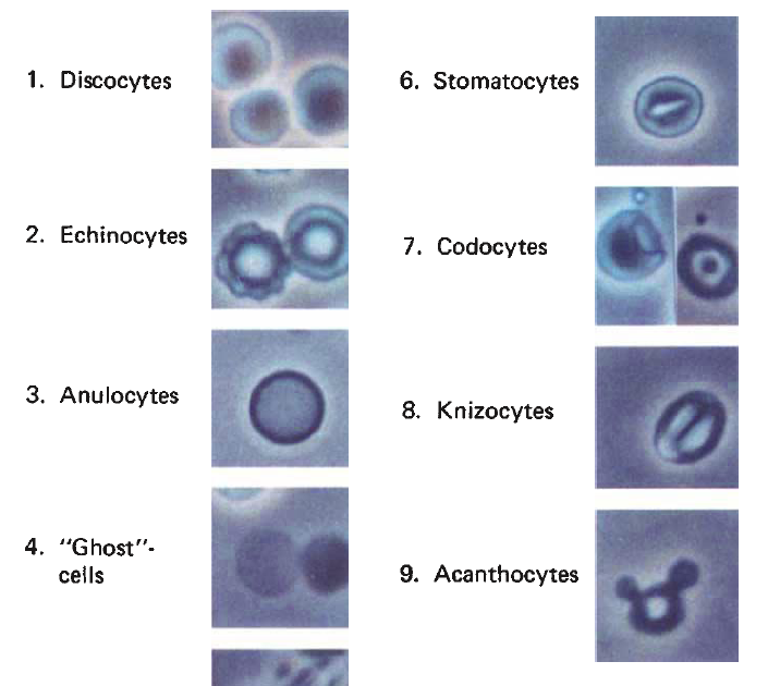 Renal Fellow Network: The Acanthocyte