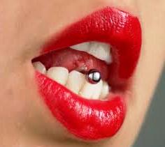 Risk of Tongue piercings can damage your teeth