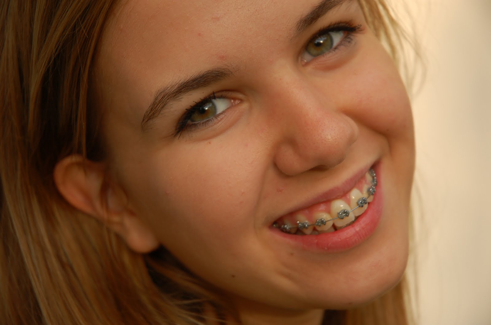 Kendras Random Ramblings Rebecca Got Her Braces Off
