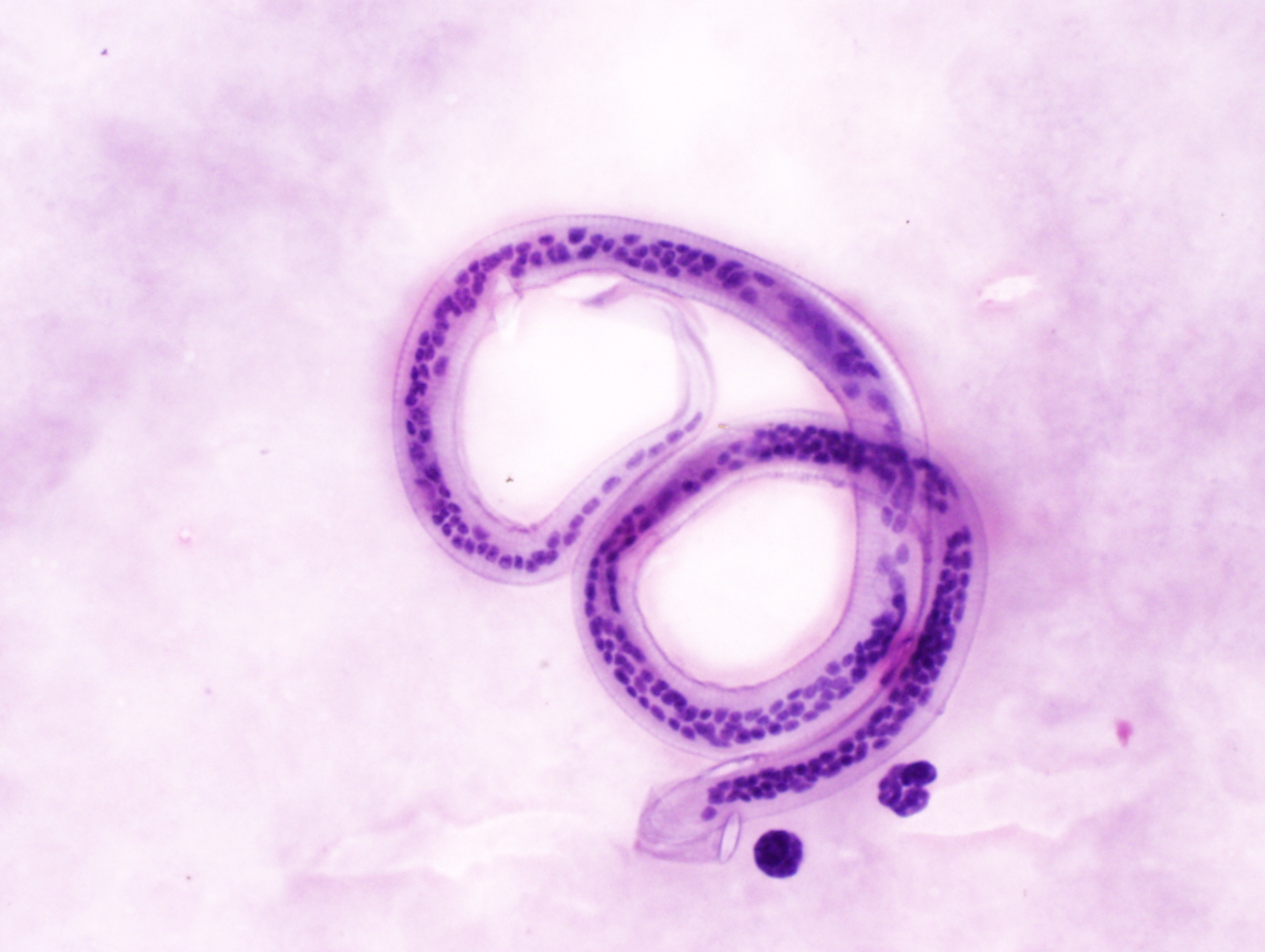 Lecture Notes in Medical Technology: Lecture #3: THE BLOOD and TISSUE ...