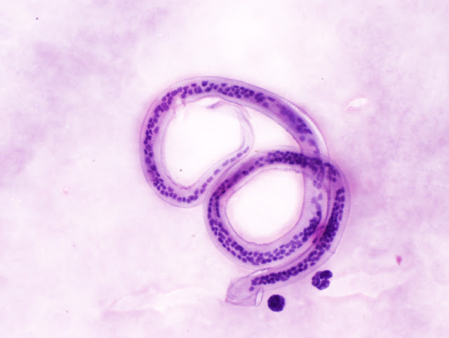 Lecture Notes in Medical Technology: Lecture #3: THE BLOOD and TISSUE ...