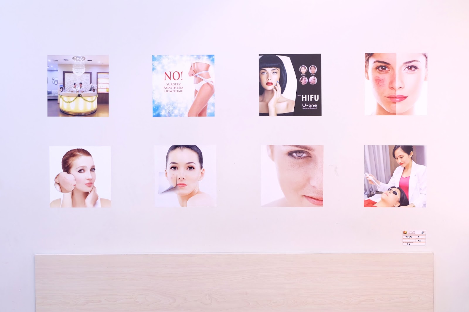 Laser & Light Skin Rejuvenation Experience at JPP Skin Laser Clinic ...