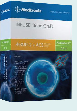 Brazilian Dental Community: Adverse Effects of InFuse