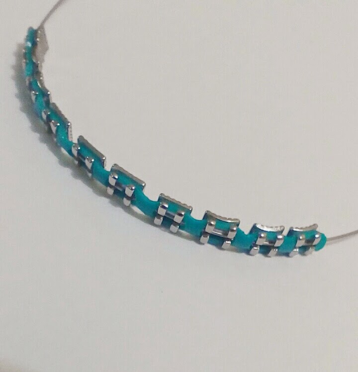 Fake Braces: Powerchain Fake Braces