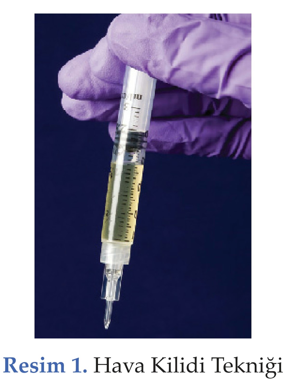 INTRAMUSKULER ENJEKSİYON UYGULAMASI: ENJEKSİYON UYGULAMA TEKNİKLERİ