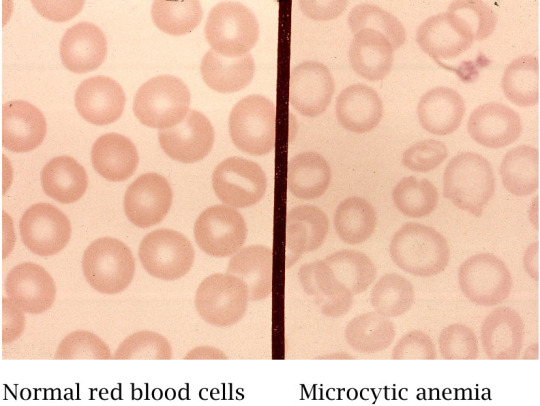 Blog Juruteknologi Makmal Perubatan @ MAD LAB BLOG: SMEAR SEL DARAH NORMAL