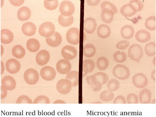 Blog Juruteknologi Makmal Perubatan @ MAD LAB BLOG: SMEAR SEL DARAH NORMAL