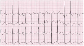 ER goldbook: EKG interpretation