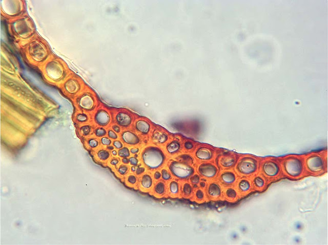 Walks with Moss: Some microscopic pictures of moss