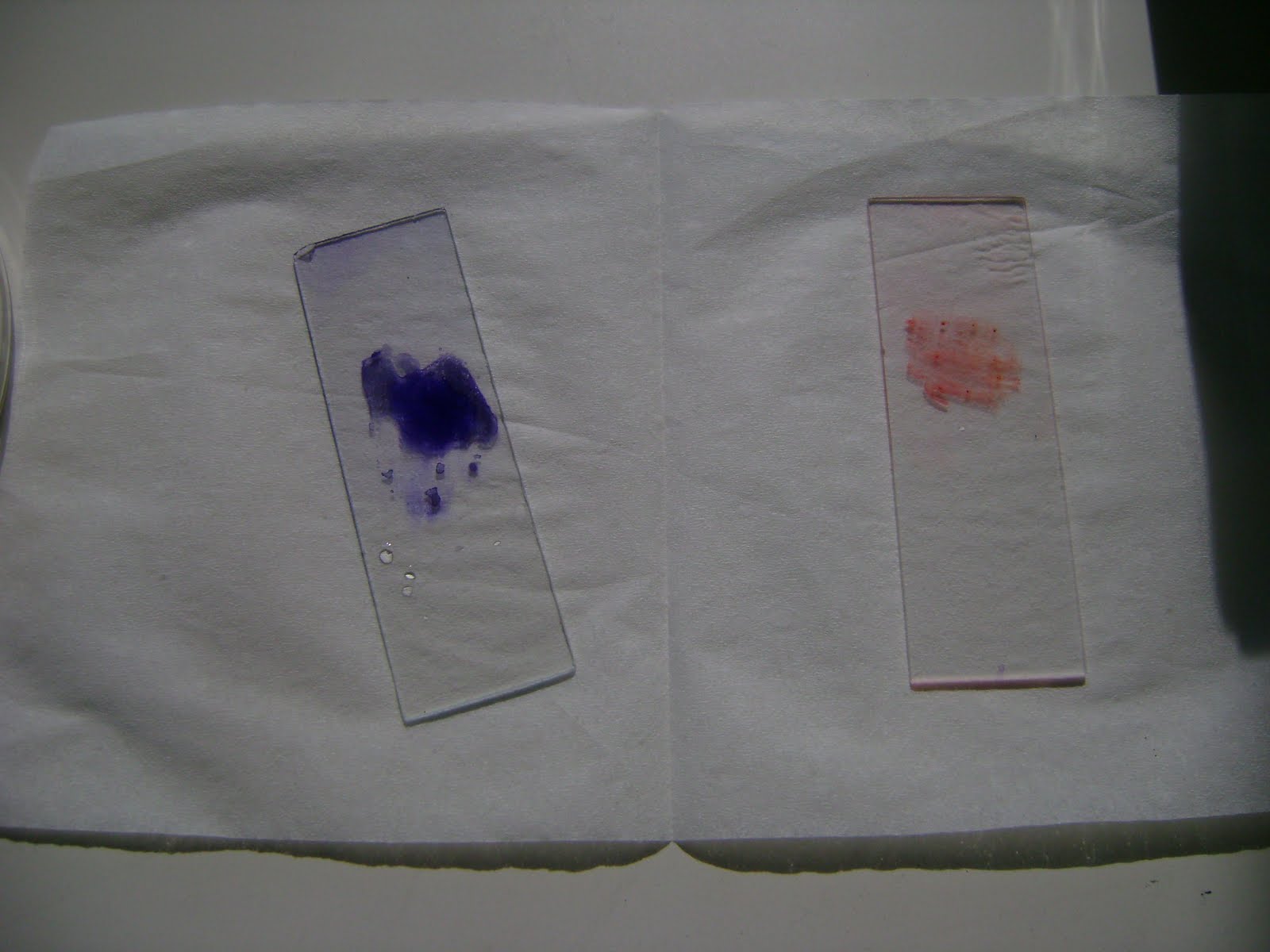 MedicALI Microbiology: Preparing and Staining a Bacterial Smear