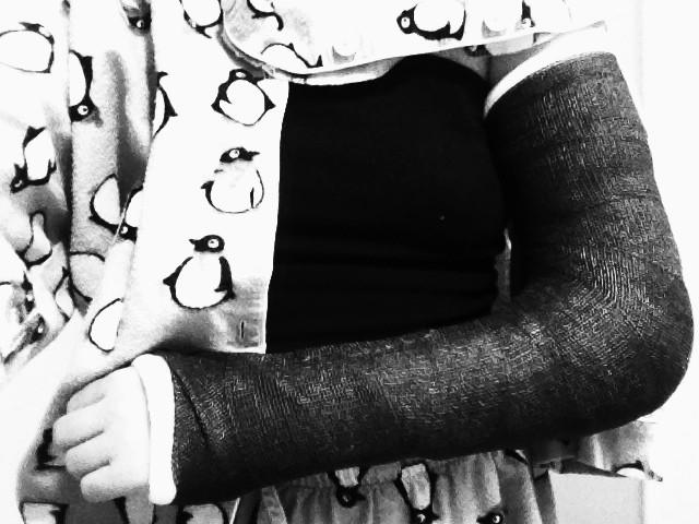 Casts and Toes: Arm Casts!!!