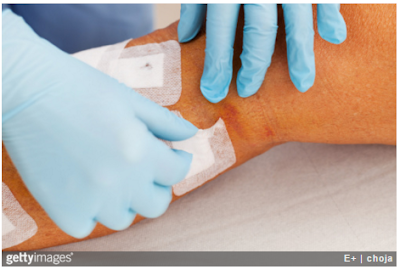 Menina e Muito Vaidosa: O que é flebite?