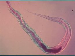 Parasitosis intestinal