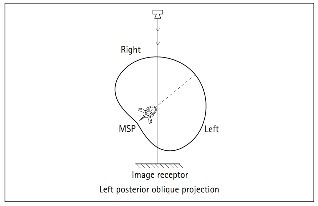 Clark's Radiography: Projection Terminology