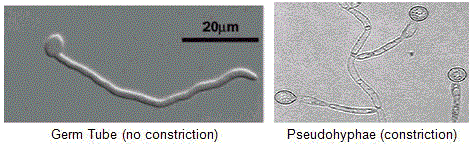 SENTHIL PRABHU SIVASAMY: Identification of Candida albicans (Germ Tube ...