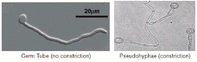 SENTHIL PRABHU SIVASAMY: Identification of Candida albicans (Germ Tube ...