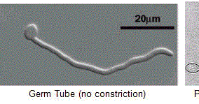 SENTHIL PRABHU SIVASAMY: Identification of Candida albicans (Germ Tube ...