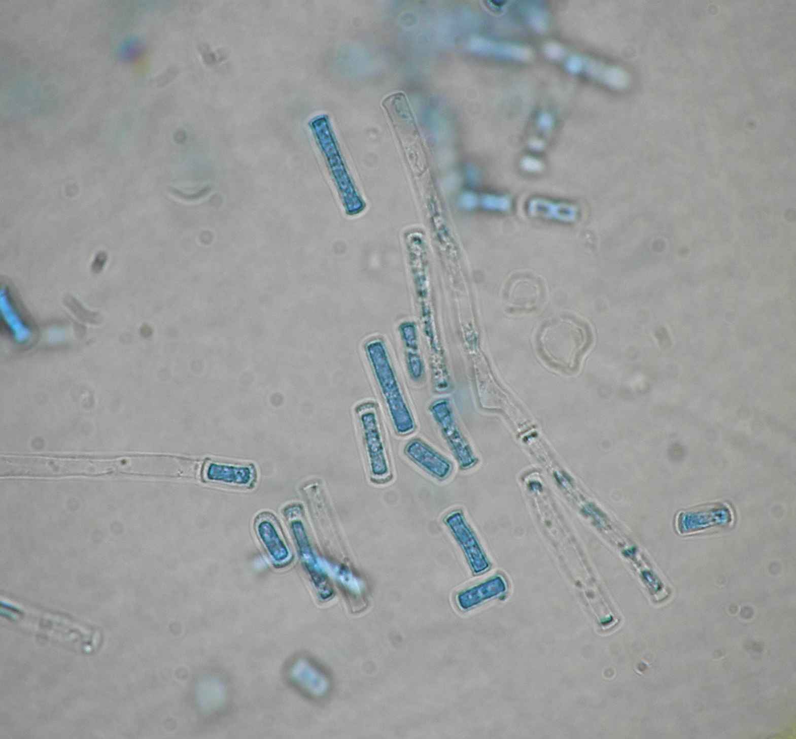 ATLAS MICOLOGIA: GEOTRICHUM CANDIDUM
