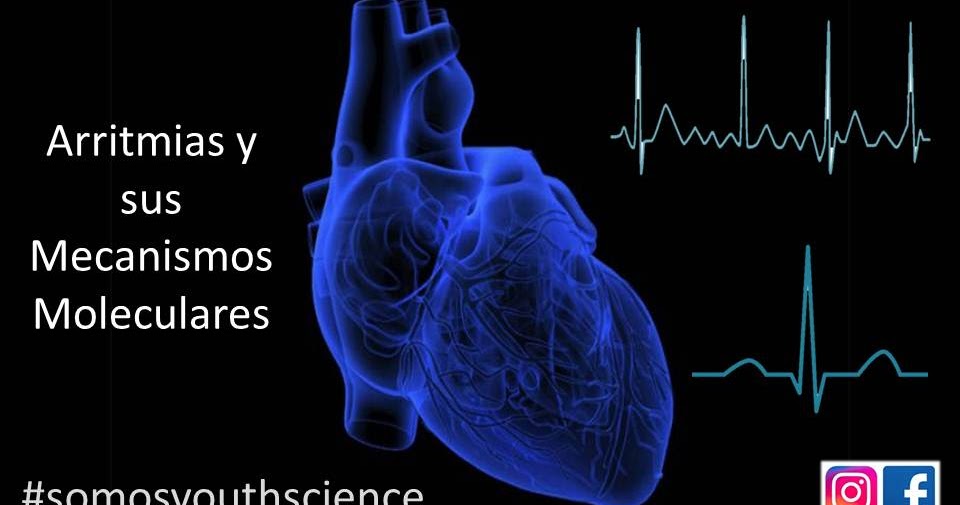 Fisiopatología de las arritmias cardiacas: rol del automatismo