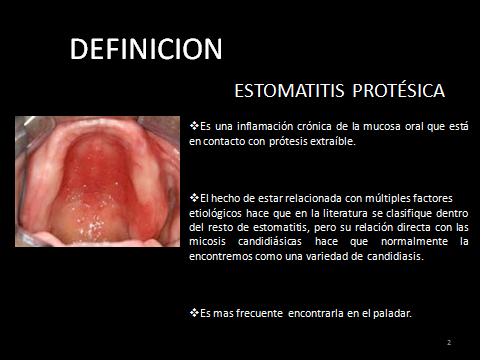 PROSTODONCIA TOTAL: Estomatitis protesica