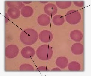 Atlas de hematologia