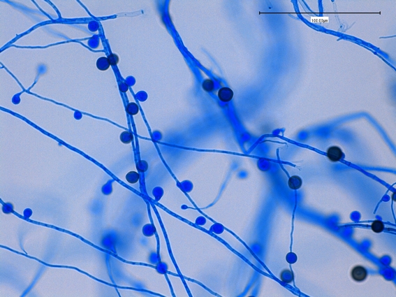 Fun With Microbiology (What's Buggin' You?): Unidentified Mould No. 2 ...