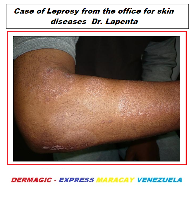 DERMAGIC EXPRESS / Dermatologia y Bibliografia - Dermatology ...