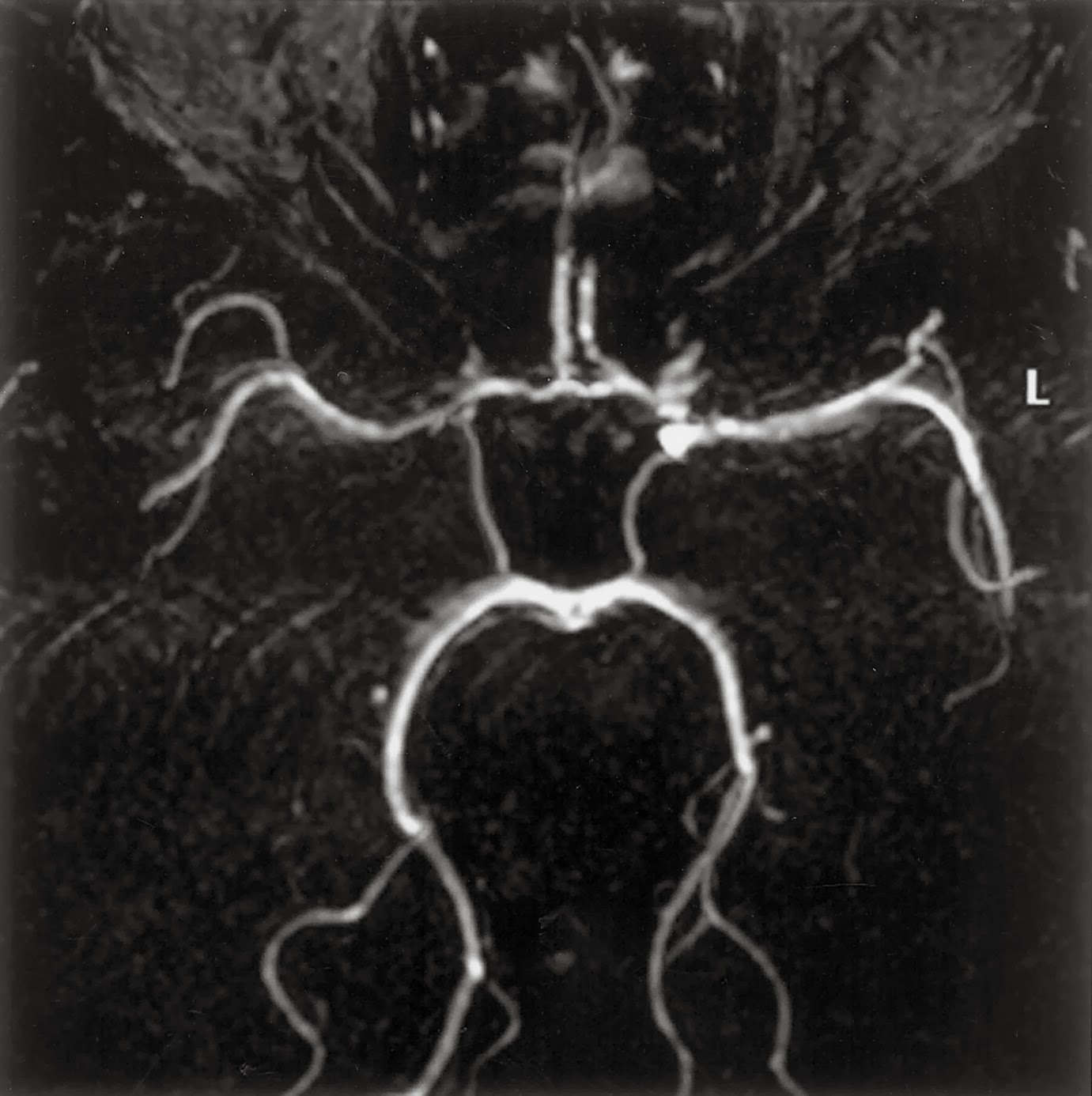 What I learned today...: For Your Information... Circle of Willis